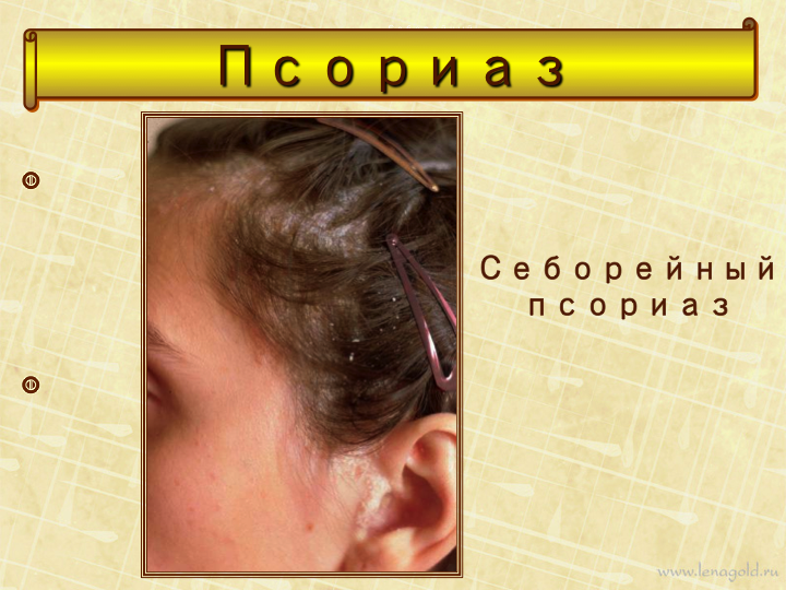 Сайт профессора Курдиной М.И. - ПС Себор